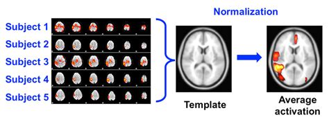 Magnetism Questions And Answers In Mri
