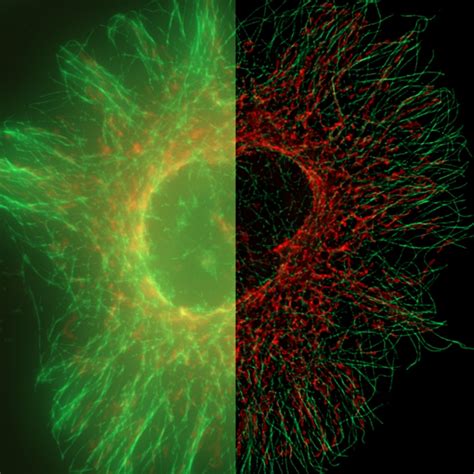 Deconvolution Toolkit Zeiss