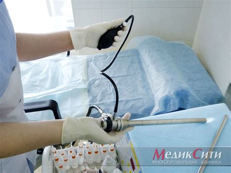 Проктит: симптомы и причины. Лечение проктита