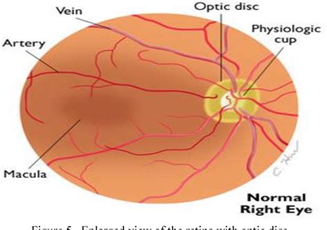 Figure 4 From Investigation Of Primary Glaucoma By Cdr In Fundus Images Semantic Scholar