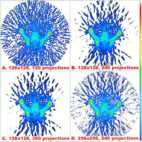 Streak Artifact Reduction In Filtered Backprojection Using A Level Linebased Interpolation