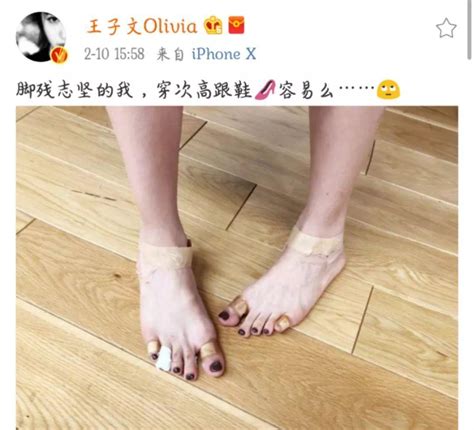 王子文微博晒高跟鞋磨伤脚学会这几招方法保证你脚不受伤 360娱乐你开心就好