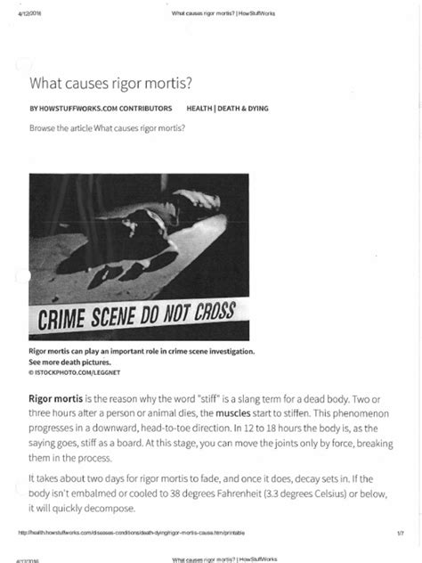 Kami Export Anmol Patel What Causes Rigor Mortis Pdf Skeletal