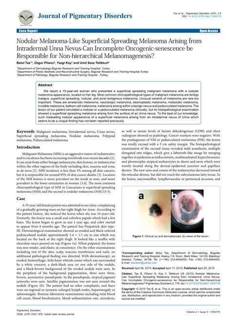 Nodular Melanoma Like Superficial Spreading Docslib
