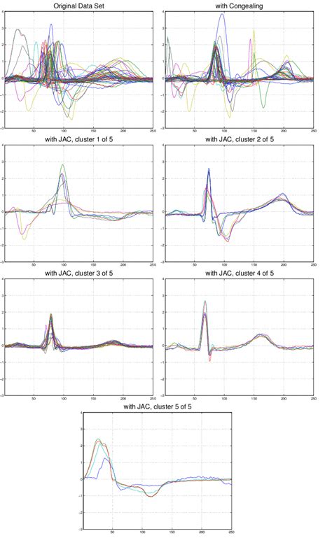 joint alignment and clustering of ecg heart data the first row