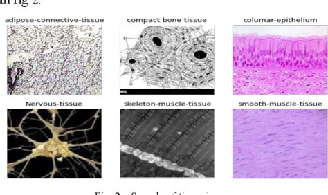 Figure 2 From Epithelial Tissue Classification Using Pre Trained Deep Convolutional Neural
