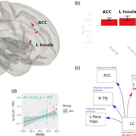 Differences Of Locus Coeruleus Lc Green Resting‐state Functional Download Scientific Diagram
