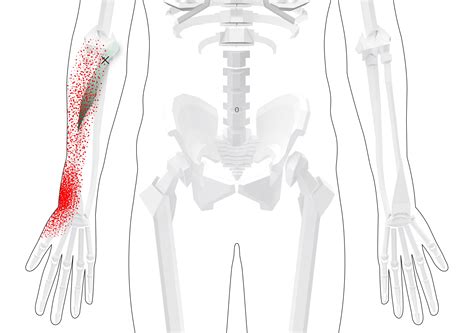 Infraspinatus Trigger Points Overview And Tips For Self Treatment
