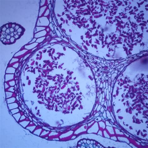 Psilotum Sporangium Whisk Fern C S 12 µm Microscope Slide
