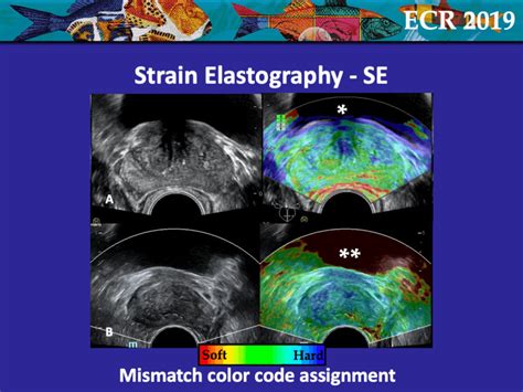 Mismatch Color Code Assignment At SE Based On The Proprietary Download Scientific Diagram