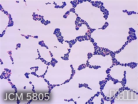 Streptococcus Lactis