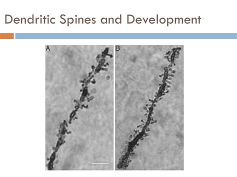 Ppt Understanding Dendritic Spines Structure Function And Synaptic
