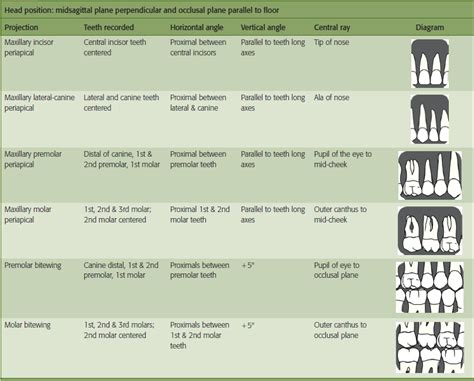 Dental Radiography Frequency Guidelines At Jerry Fifield Blog