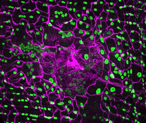 Cells With Extra Genomes May Help Tissues Respond To Injuries—and