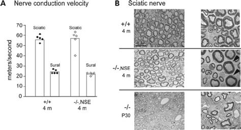 Nerve Conduction Velocity And Morphology A Motor Nerve Conduction
