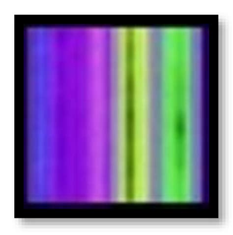 Jpm Free Full Text Using Efficientnet B7 Cnn Variational Auto