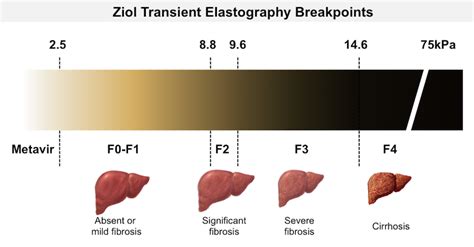 Fatty Liver Fibrosis Score Chart Herbs And Food Recipes Free Download
