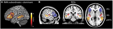 Regions Of Interest Rois Used In The Meg Rsa Analysis A