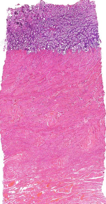 Uterus Light Micrograph Stock Image C024 0113 Science Photo Library