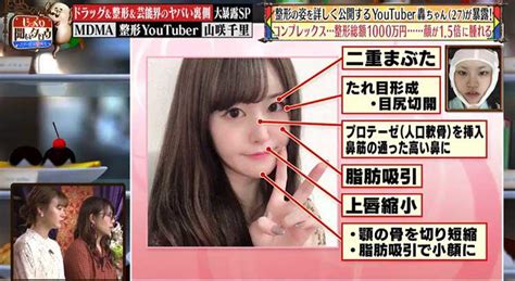 300万回再生突破！ 衝撃的なあご動画が話題の整形youtuber轟ちゃんが、整形の一部始終を公開：じっくり聞いタロウ テレビ東京・bs