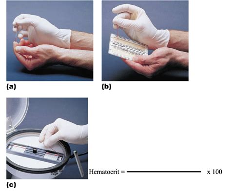 Steps In Hematocrit Determination Diagram Quizlet