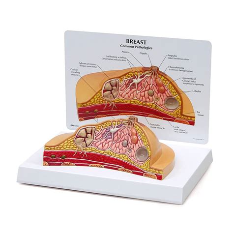 Buy Female Profile Structure Anatomical Model Cancer Pathological