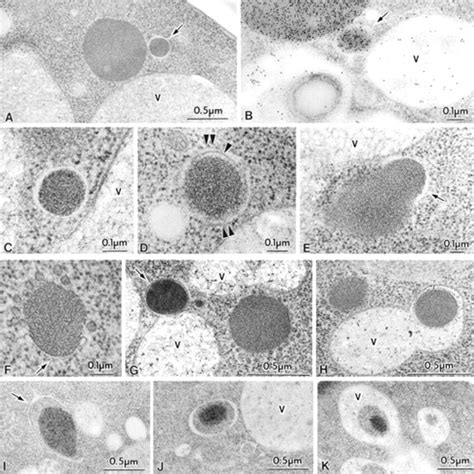 Transport Of Cvt Complex In Sey6210 Wild Type Harboring 2μ Plasmid Download Scientific