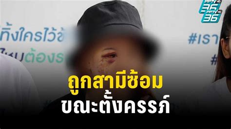 สาววัย 19 ร้อง ถูกสามีซ้อมจนสลบข้ามคืนขณะตั้งครรภ์ โชว์ข่าวเช้านี้ 30 ต ค 66 Youtube