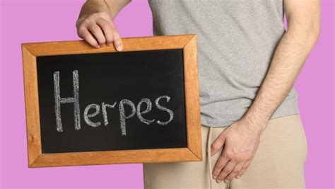 Herpes Genital Homens
