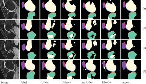 UNet UNet Att UNet UNet3 And Some Example Segmentation Plots Of