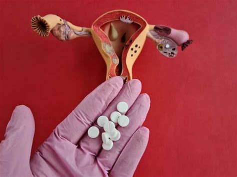 Metformin Vs Metformin Extended Release For Pcos