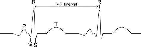 The Ecg Ekg Ecg Leads Physiology Teachmephysiology