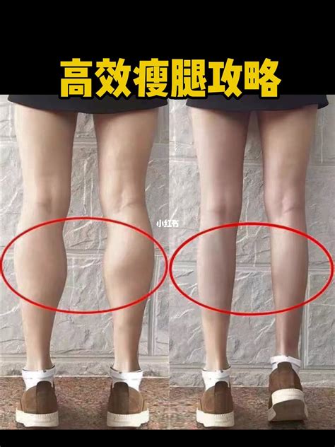 女生瘦腿的最快方法 腿太粗怎么瘦腿 未命名 追马博客
