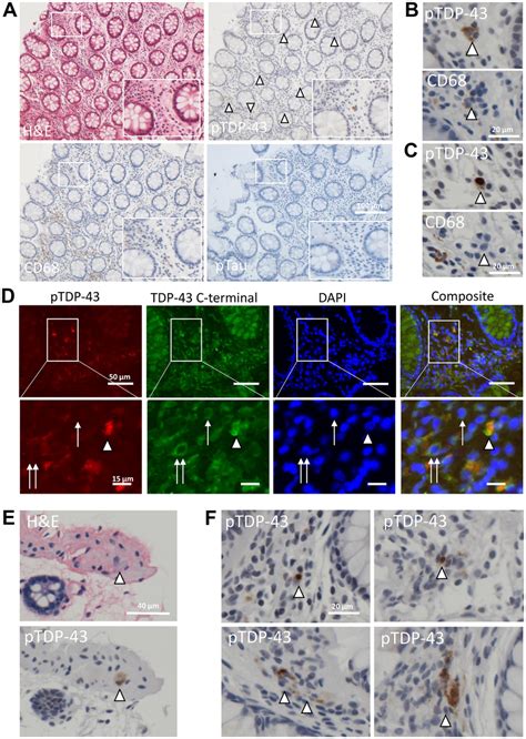 Ptdp‐43 Aggregates Are Present In Lamina Propria And Nerve Bundles Of