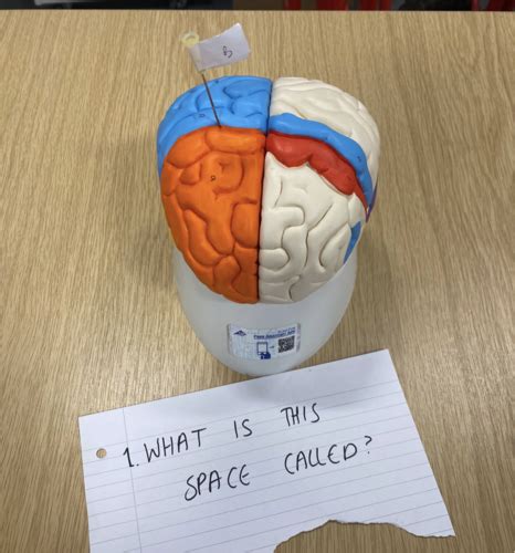 Neuro Spotter Mock Flashcards Quizlet