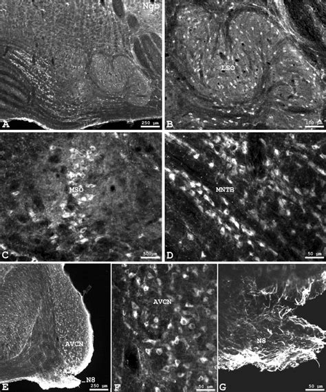 Neuroglobin Ngb Protein Distribution In The Rat Superior Olivary