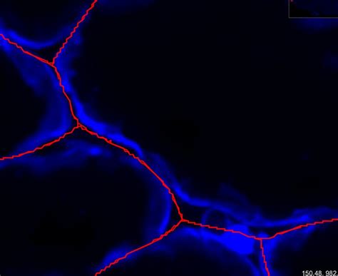 Qupath Muscle Cell Segmentation Annotation Thickness Image Analysis