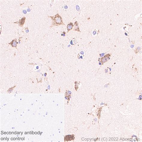 Anti Hexa Antibody Epr26393 80 Ab303484 Abcam