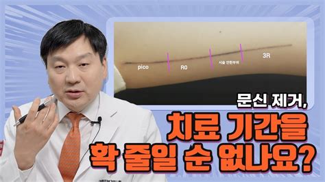 몇 년은 걸리는 문신 제거 최대한 빨리 끝내는 방법 피부지킴이 문신제거 문신 3r문신제거 3r콤보 Youtube