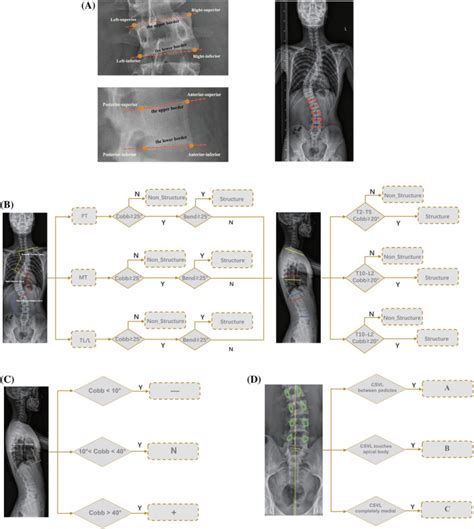 Automatic Lenke Classification Of Adolescent Idiopathic Scoliosis With