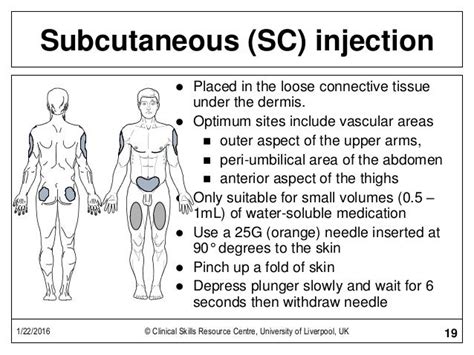 Subcutaneous Injection Technique