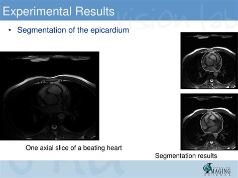 Ppt Segmenting Dynamic Textures With Ising Descriptors Arx Models