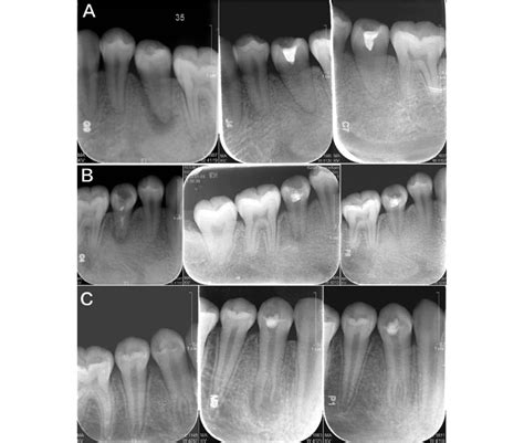 X Ray Radiography Showed The Results Of Three Cases In The Experimental Download Scientific