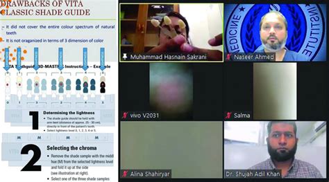 Aidm Webinar On 3d Shade Guide Teeth Selection