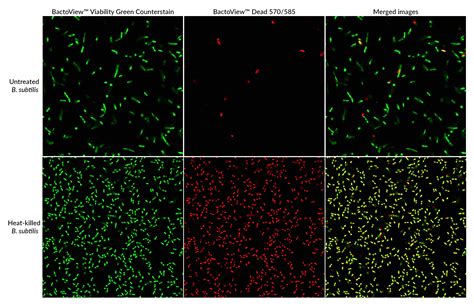 Biotium Introduces New Highly Selective Stains For Both Gram Positive And Gram Negative Bacteria