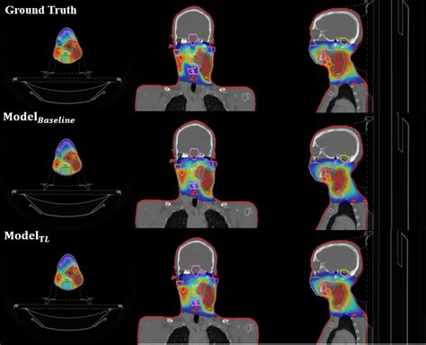 Medical Physics — Biomedical Engineering At Utsw