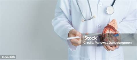 해부학적 신장 부신 모델을 들고 있는 의사 비뇨기계 및 결석의 질병 암 세계 신장의 날 만성 신장 비뇨기과 신장염 신장 및 이식 개념 3월에 대한 스톡 사진 및 기타 이미지