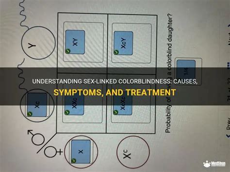 Understanding Sex Linked Colorblindness Causes Symptoms And Treatment Medshun