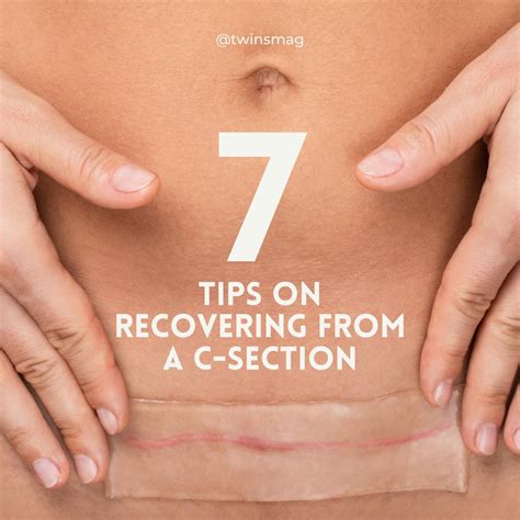 Twins™ Magazine C Section Twins Yes Momma Needs To Facebook