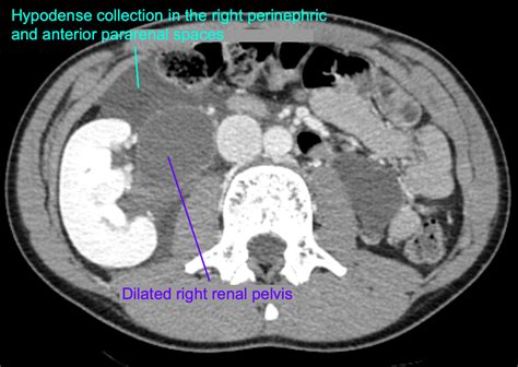 CT Case LITFL CT Scan Interpretation